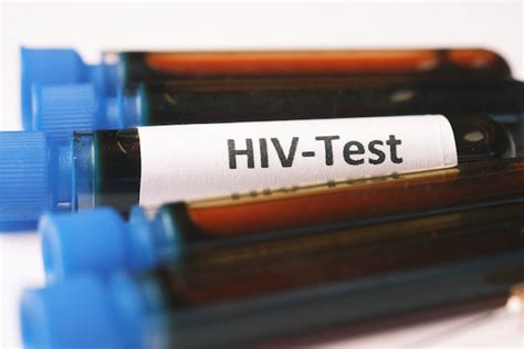 Hiv Viral Load Chart And Example Free Pdf Download