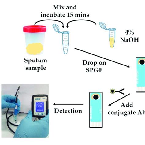 Current Measured Using Portable Reader From 10 Clinical Sputum Samples Download Scientific