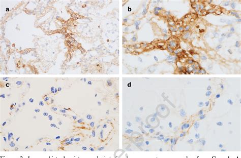 Alveolar Epithelial Cells Semantic Scholar