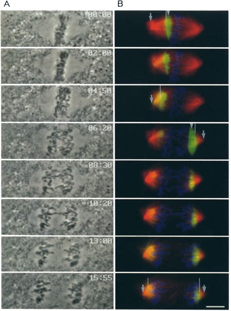 Shift In Mt Movement At The Metaphase Anaphase Transition Measured In A