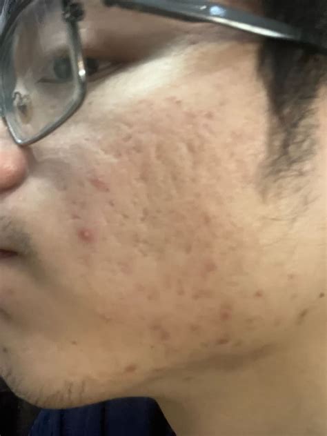 問 想請問一下 男性保養板 Dcard
