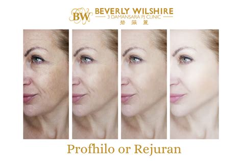 Profhilo Vs Rejuran Which Is Better Beverly Wilshire Clinic