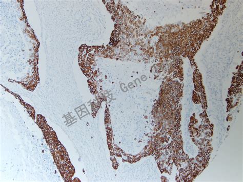 细胞角蛋白 5and6 抗体 兔抗人 Ck56