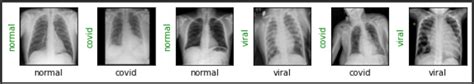 GitHub VaasuCodez Detecting COVID With Chest X Ray Using PyTorch Objective Of This Project
