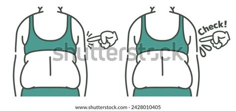 Visceral Adiposity Index Metabolic Syndrome Over 2 Royalty Free