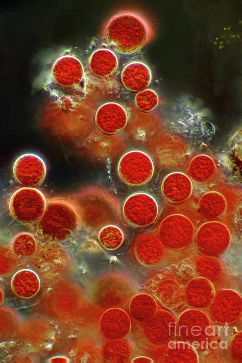 Haematococcus Pluvialis By Science Photo Library