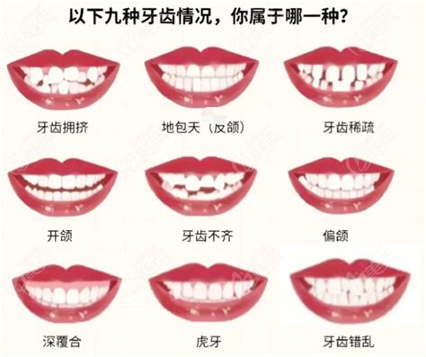 昆明好的正畸医院推荐哪几家昆明美奥柏德口腔牙齿矫正好且平价 美佳社区