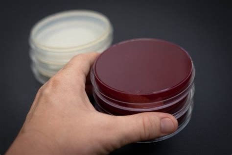 Cum Tratam Infectiile Cu Streptococi
