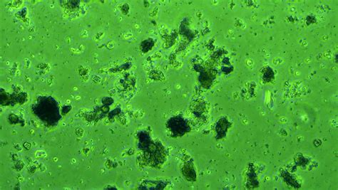 Stockvideoclip Van Plaque Bacteria From Mouth Seen In Phase Shutterstock