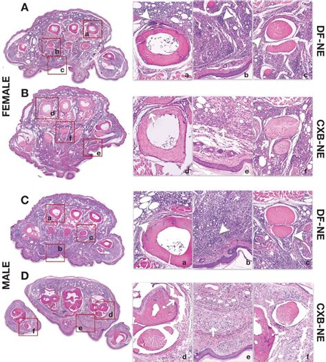 Sex Differences Revealed In A Mouse Cfa Inflammation Model With
