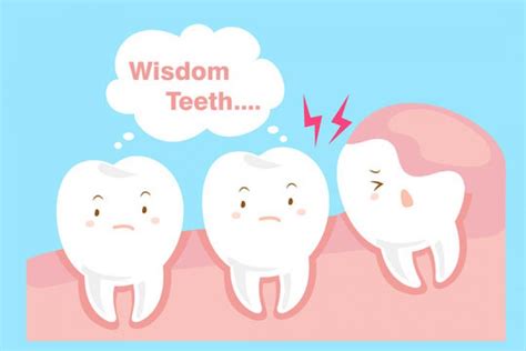 How To Sleep After Wisdom Teeth Removal Stylebuzzer