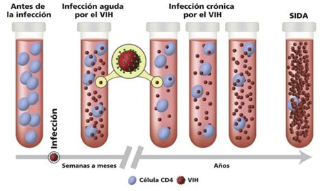 Cuanto Tiempo Dura Una Persona Con Sida En Fase Terminal Cuanto Tiempo Dura Una Persona Con Sida En Fase Terminal