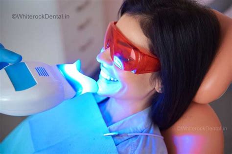 In And Out In Under An Hour Get A Star Ready Smile Fast Whiterock