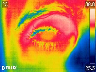Glaucoma Classification Dataset By New Workspace 1dxty
