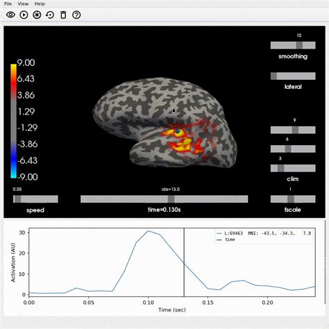 Enh New Interface For Brain · Issue 7162 · Mne Toolsmne Python · Github