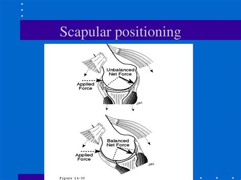 Ppt Shoulder Instability Powerpoint Presentation Free Download Id