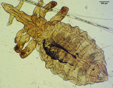 Louse Identification Key