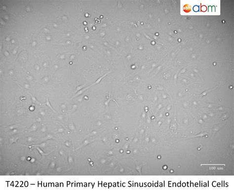 Human Primary Hepatic Sinusoidal Endothelial Cells Applied Biological Materials Inc