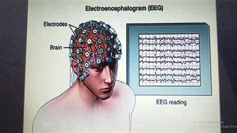 Electroencephalogram Eeg Uses Procedure Results