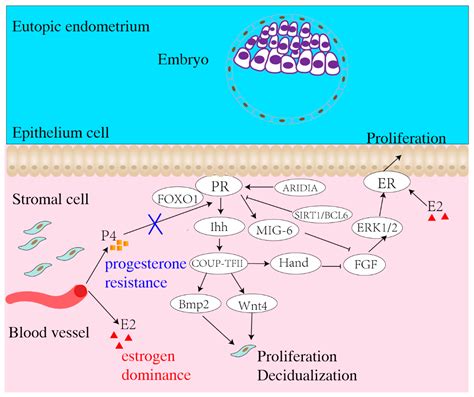 Towards A Better Understanding Of Endometriosis Related Infertility A