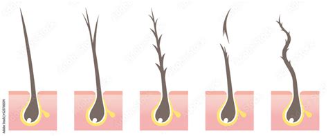 Types Of Hair Problems Cross Section Normal Split Ends Damaged