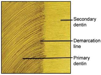 Primary Dentin