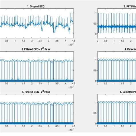 The High Pass Filtered Ecg Signal Download Scientific Diagram