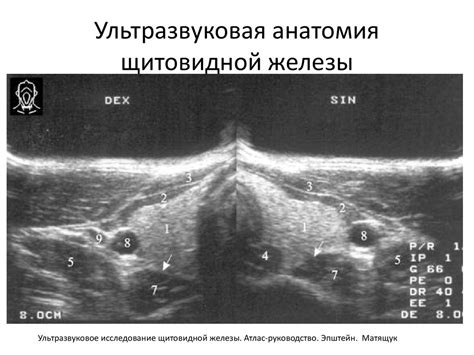 Ультразвуковая диагностика узловых образований щитовидной железы