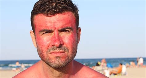 The Longevity Molecule Facilitates Dna Repair Happi