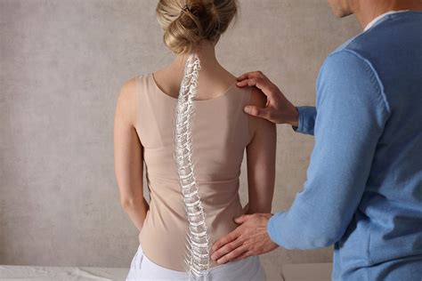 Hyperkyphosis Symptoms Causes Diagnosis And Treatment