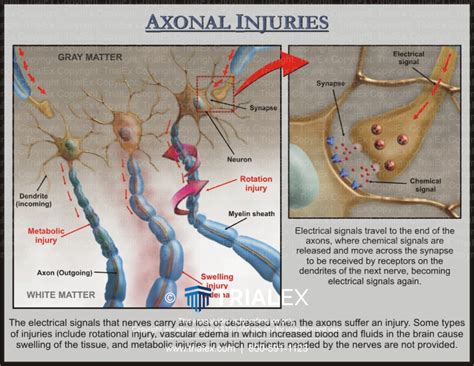 Axonal Injuries