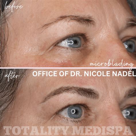 Microblading Archives Totality Medispa