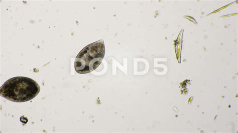 Ciliates Under Microscope