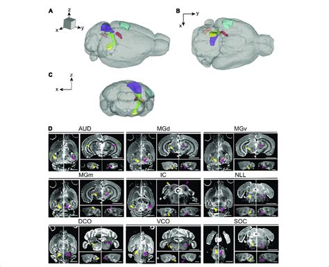 Magnetic Resonance Imaging Of The Auditory Pathway A C 3d Volume