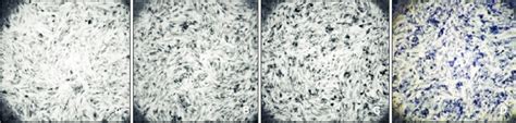 Monolayer Culture Of The 10459 Human Gingival Fibroblast Hgf Cell
