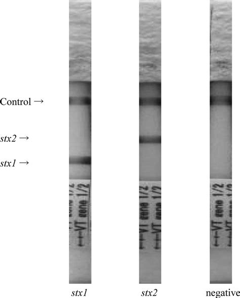 Results Of Detection With The Nalfa Nucleic Acid Lateral Flow Assay Download Scientific