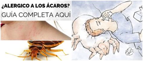 Alergia A Los Ácaros ¿es Común ¿qué Son Los Ácaros Dónde Se
