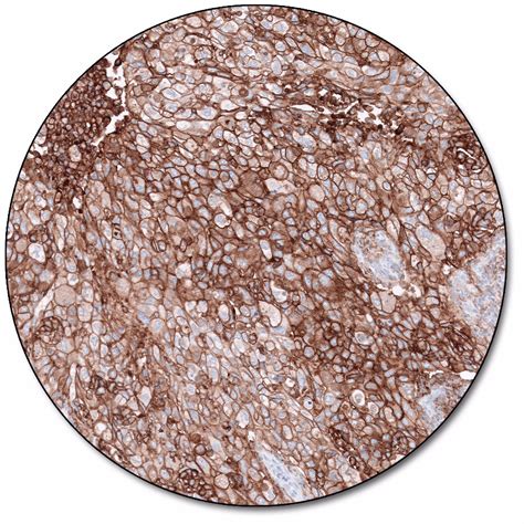 Pd L1 Ihc 22c3 Pharmdx For Use With Dako Omnis Agilent