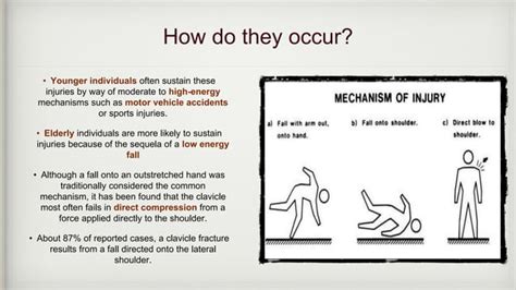 Clavicular Fracture Pptx