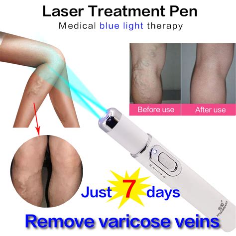 Portable Therapy Pen Wrinkle Scar Acne Remover Device Powerful Blue