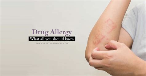 Drug Allergies In Bangalore