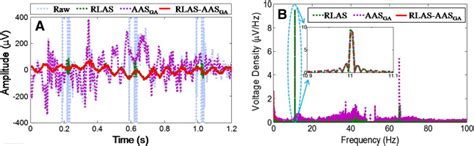 Eeg Signals Recorded From The Spherical Phantom Containing A Current