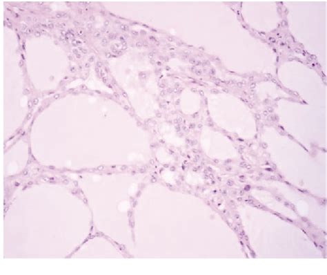 Fumarase Deficiency Semantic Scholar