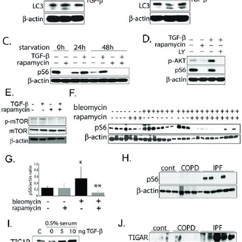 Hydroxyproline Assay Measuring Lung Collagen Content Demonstrates