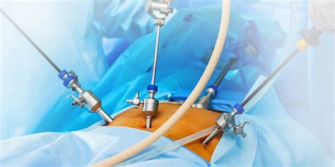 Diagnostic Laparoscopy In Pune Kaizen Gastro Care