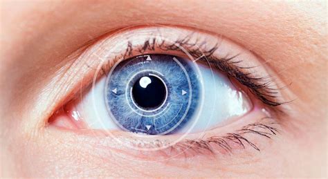 ICL Linsenimplantation eine gute Lösung für hohe Kurzsichtigkeit