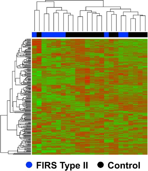 Transcriptome Analysis Of Fetal Blood Using Whole Genome Dasl® Assay