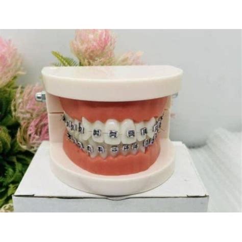 Generic Fancy Classy Braces White Jumia Nigeria