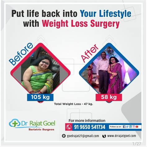 Dr Rajat Goel On Linkedin Bariatric Surgery Is A Metabolic Surgery And