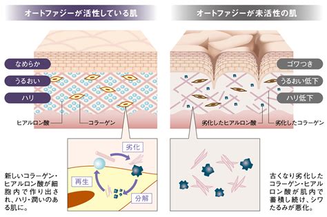 オートファジーって。 先取り！健康生活主義